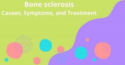 Bone sclerosis: Causes, Symptoms, and Treatment - Biology Educare